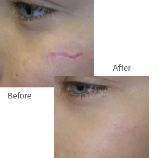 Infusions and Injections – Dr. Rachael DelToro